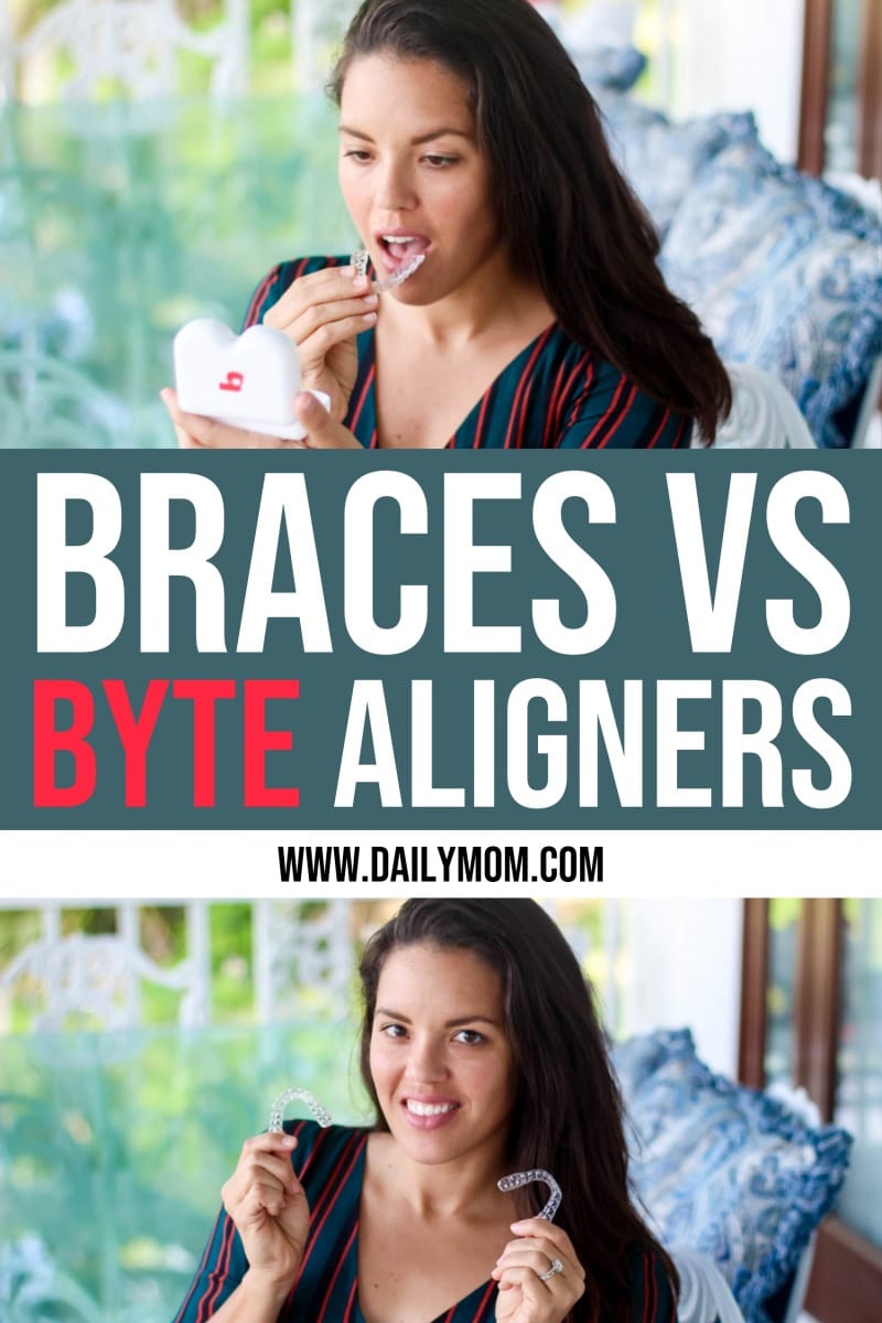 6 Reasons Why Byte Invisible Aligners are the Perfect Alternative to ...