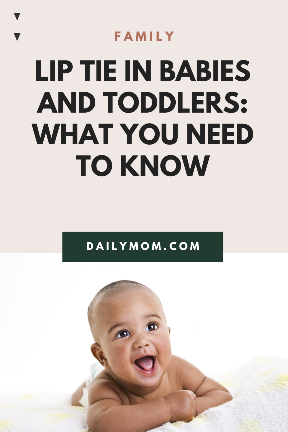 Lip Tie In Babies And Toddlers: Practical Tips That You Need To Know ...